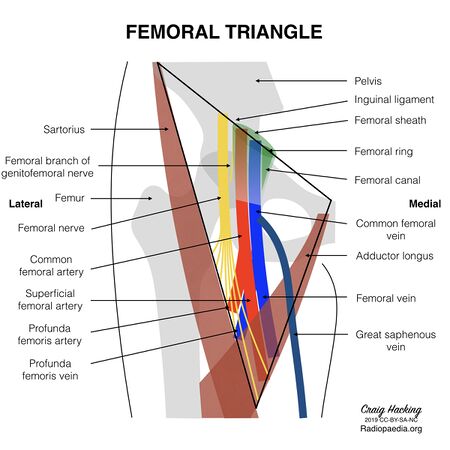 Femoral Triangle - WikiSM (Sports Medicine Wiki)