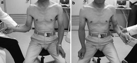 Dropping Sign - WikiSM (Sports Medicine Wiki)
