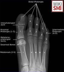 Metatarsophalangeal Joints - WikiSM (Sports Medicine Wiki)