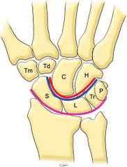 Scapholunate Joint - WikiSM (Sports Medicine Wiki)