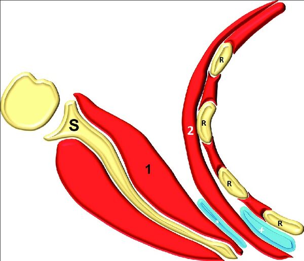 Scapulothoracic Joint - WikiSM (Sports Medicine Wiki)