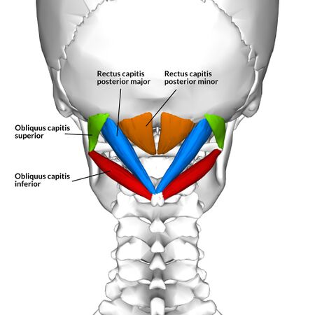 Suboccipital Muscles - WikiSM (Sports Medicine Wiki)