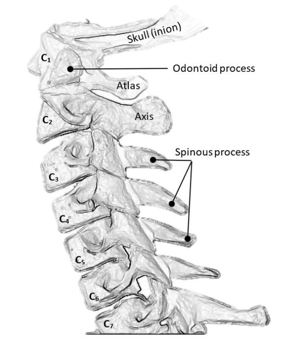 Cervical Spine Anatomy - WikiSM (Sports Medicine Wiki)