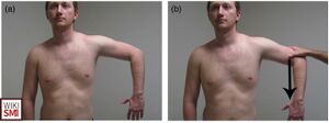 Lateral Jobe Test - Rotator Cuff Tear - WikiSM (Sports Medicine Wiki)