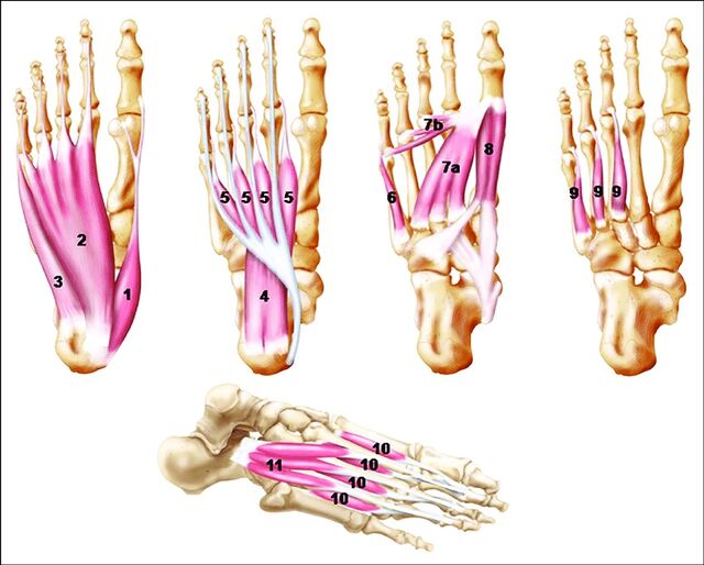 Intrinsic Muscles of the Foot - WikiSM (Sports Medicine Wiki)