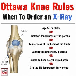 Ottawa Knee Rules - WikiSM (Sports Medicine Wiki)