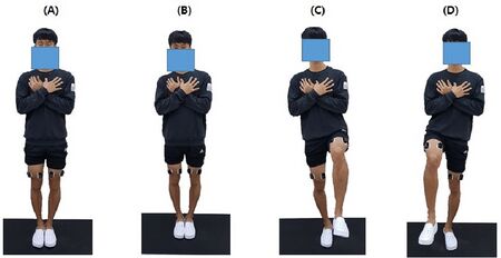Romberg Test - WikiSM (Sports Medicine Wiki)