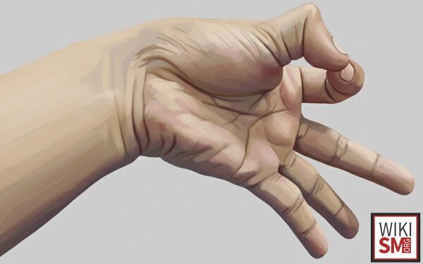 Jeanne’s Sign - Ulnar Nerve Palsy - WikiSM (Sports Medicine Wiki)