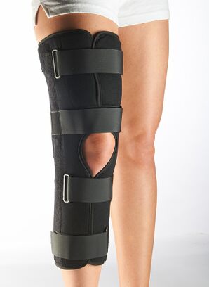 Patellar Fracture - WikiSM (Sports Medicine Wiki)