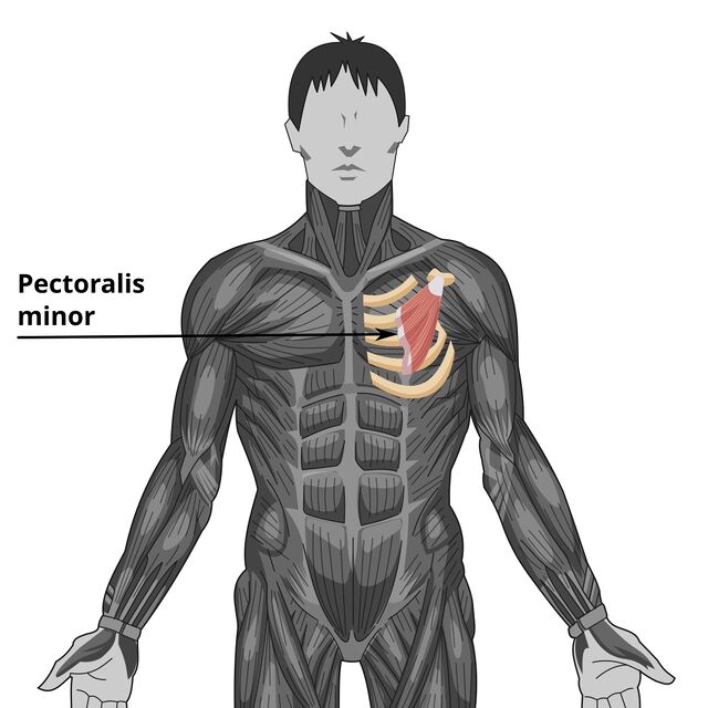 Pectoralis Minor - WikiSM (Sports Medicine Wiki)
