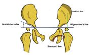 Standard Radiographs Pelvis - WikiSM (Sports Medicine Wiki)