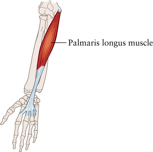 Palmaris Longus - WikiSM (Sports Medicine Wiki)