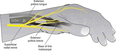 Wartenbergs Syndrome - WikiSM (Sports Medicine Wiki)