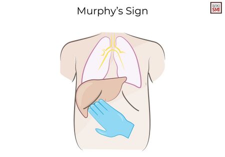 Murphy's Sign (Cholecystitis) - WikiSM (Sports Medicine Wiki)