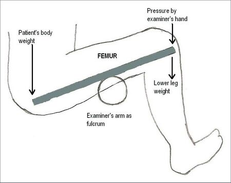 Fulcrum Test - WikiSM (Sports Medicine Wiki)
