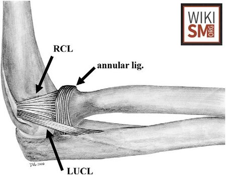 Lateral Collateral Ligament Complex of the Elbow - WikiSM (Sports ...