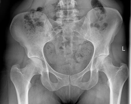 Hip Joint - WikiSM (Sports Medicine Wiki)