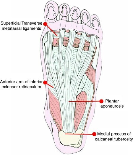 Plantar Fascia - WikiSM (Sports Medicine Wiki)