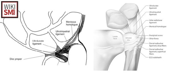Triangular Fibrocartilage Complex (TFCC) - WikiSM (Sports Medicine Wiki)