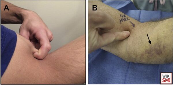 Hook Test - WikiSM (Sports Medicine Wiki)