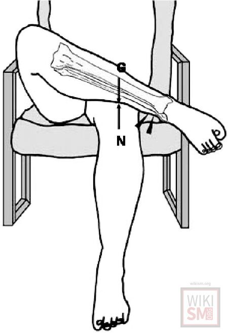 Crossed Leg Test - WikiSM (Sports Medicine Wiki)