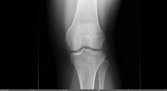 Standard Radiographs Knee - WikiSM