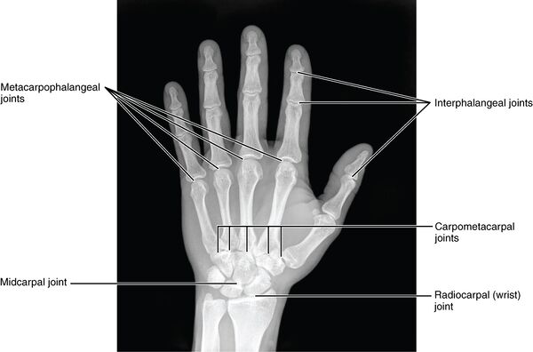 Interphalangeal Joints of the Hand - WikiSM (Sports Medicine Wiki)