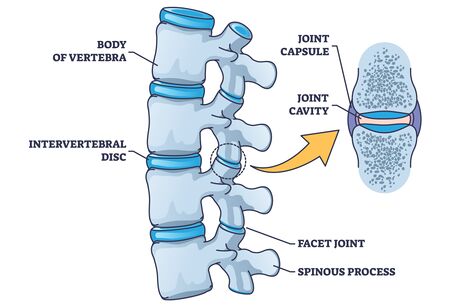 Zygapophyseal Joint - WikiSM (Sports Medicine Wiki)