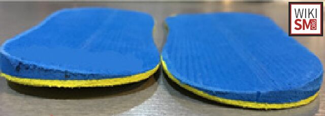 Lateral Wedge - WikiSM (Sports Medicine Wiki)