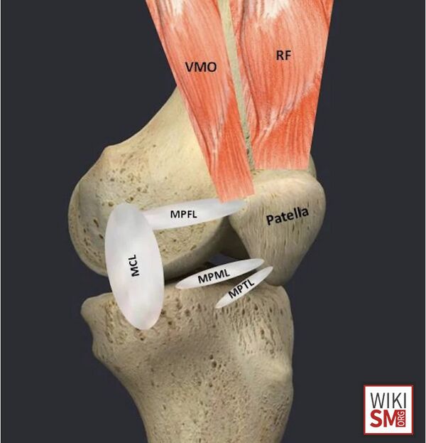 Medial Collateral Ligament - WikiSM (Sports Medicine Wiki)