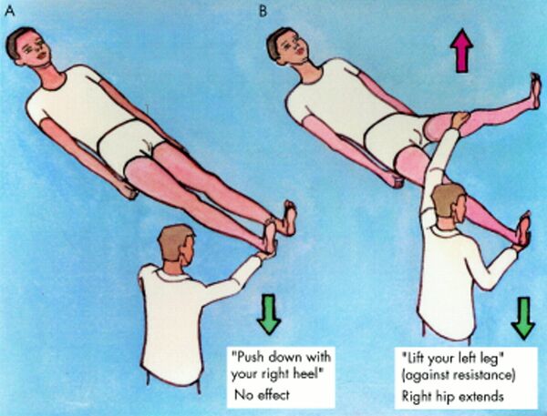 hoover-s-sign-wikism-sports-medicine-wiki