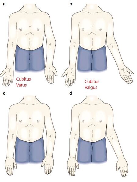 Physical Exam Elbow WikiSM Sports Medicine Wiki 