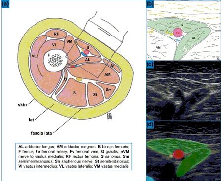 Adductor Canal - WikiSM (Sports Medicine Wiki)